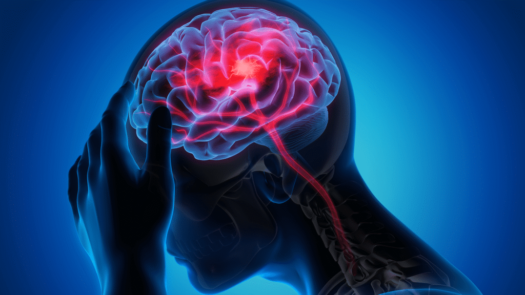 Como um pequeno hábito pode salvar você de um AVC - TEX